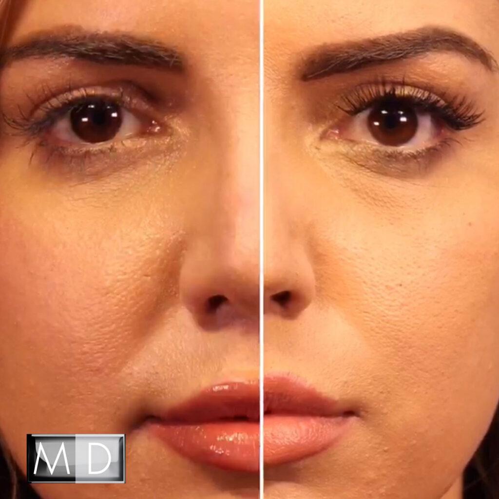 Before & After Archive - Lemmon Avenue Plastic Surgery & Laser Center ...