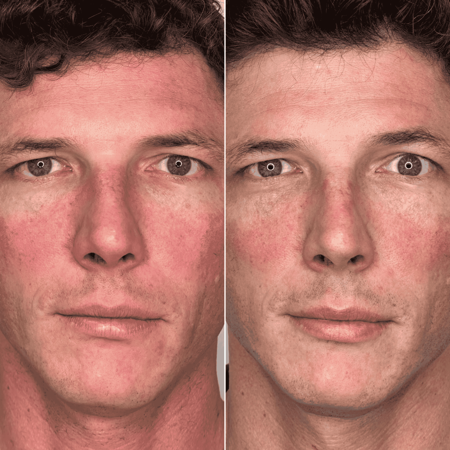 Before & After Archive - Lemmon Avenue Plastic Surgery & Laser Center ...